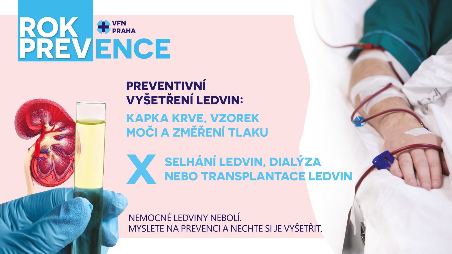 Nechte si vyšetřit ledviny – Všeobecná fakultní nemocnice v Praze